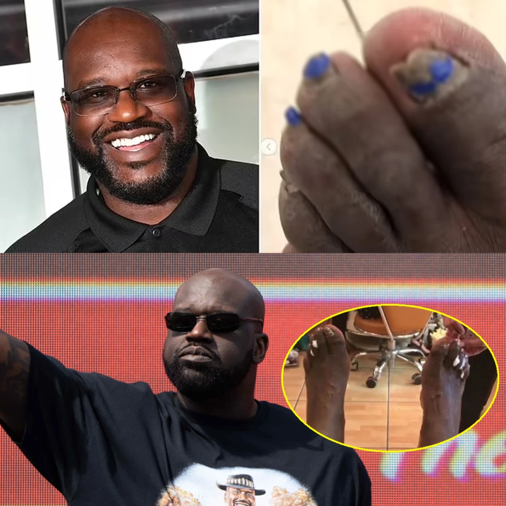 Shaquille O’Neal Showed Off His Gnarly Toes During Wild ‘Inside the NBA ...