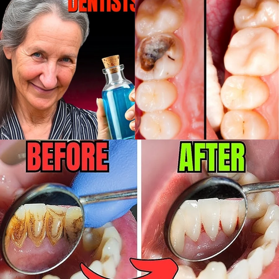 Discover the Secret to Naturally Supporting Your Teeth and Gums — A ...