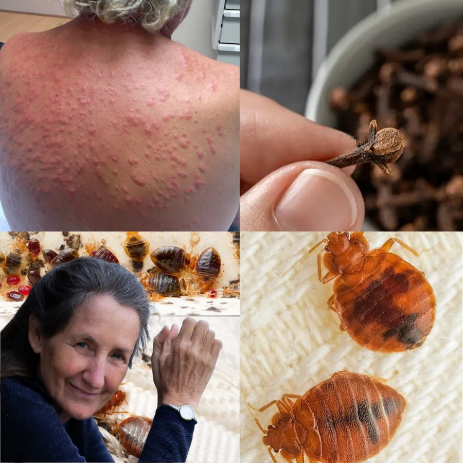 Natural Pest Control: Using Diatomaceous Earth and Cloves Against Bed ...