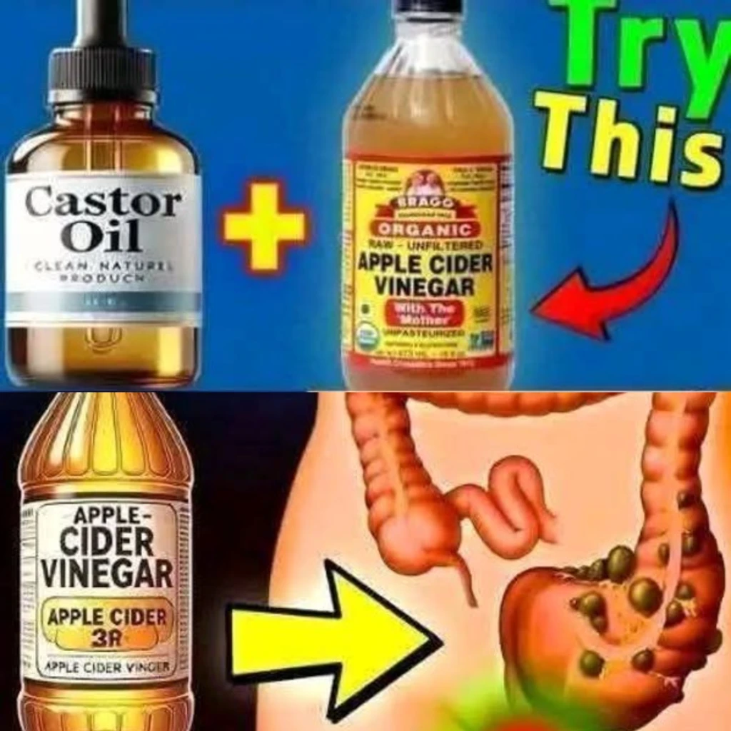 Discover the Magic of Castor Oil and Apple Cider Vinegar - News
